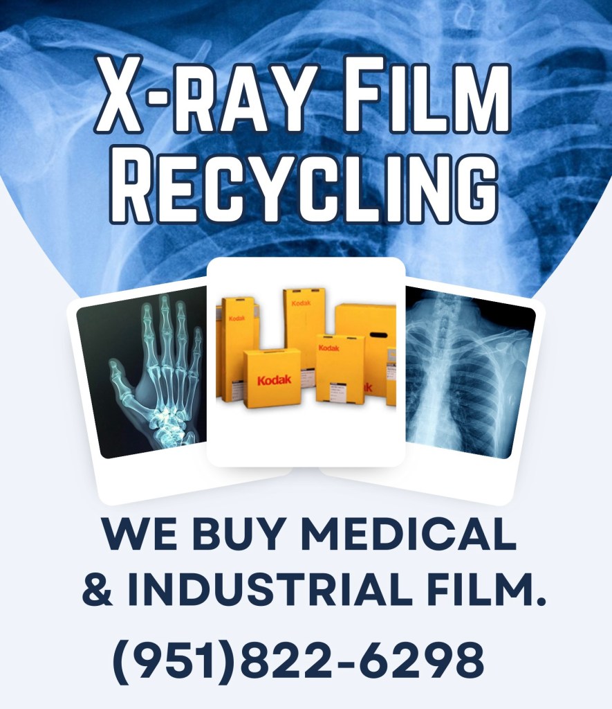 X-ray Film Recycling Beverly Hills Free Pickup - Cash for Xray Film